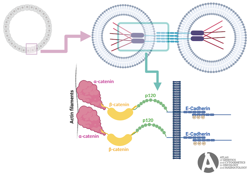 Exploring Meningioma Tumorigenesis via the E-Cadherin/β-Catenin ...