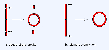 Ring Chromosome